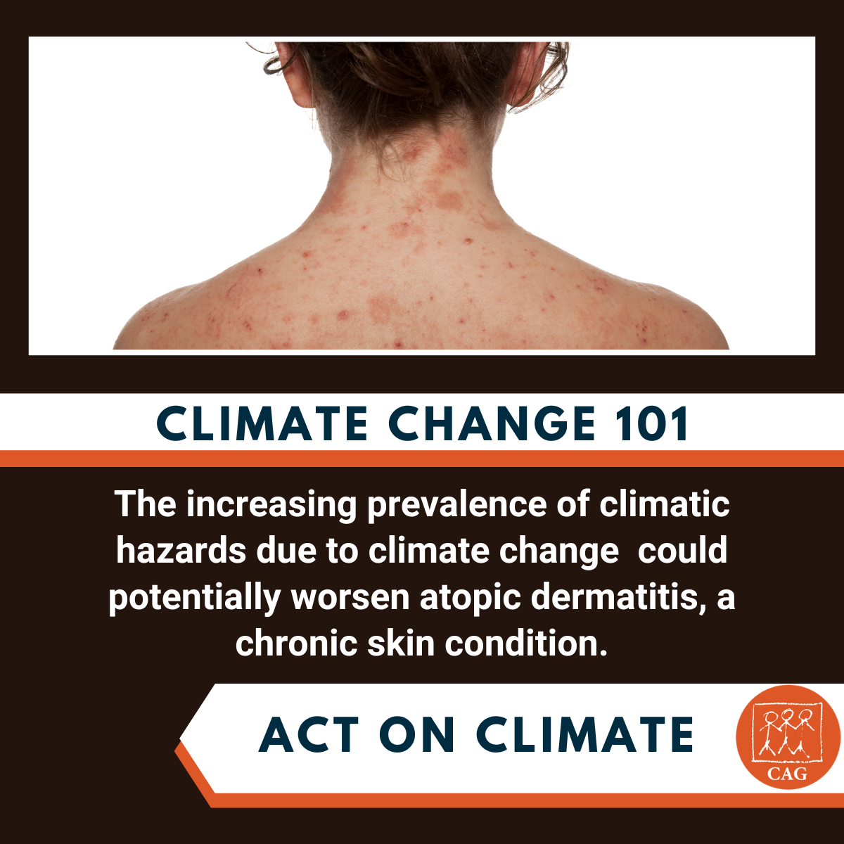 Climate Change - Higher pollen levels | Climate Connection